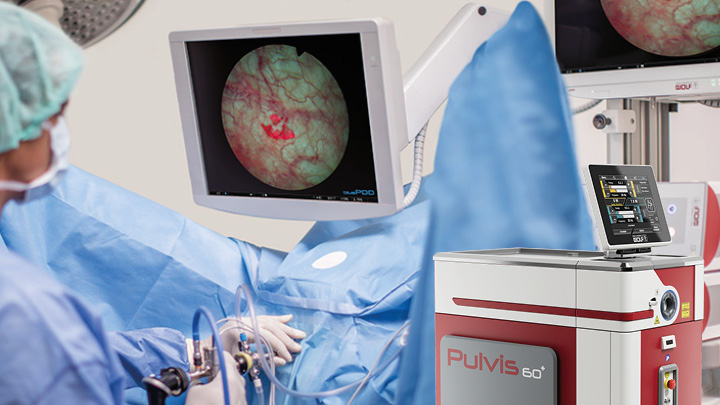 En bloc enucleation of bladder tumors with Thulium Fiber laser under PDD - Richard Wolf